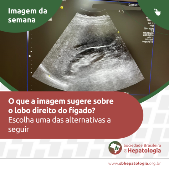 Imagem da Semana – Sociedade Brasileira de Hepatologia